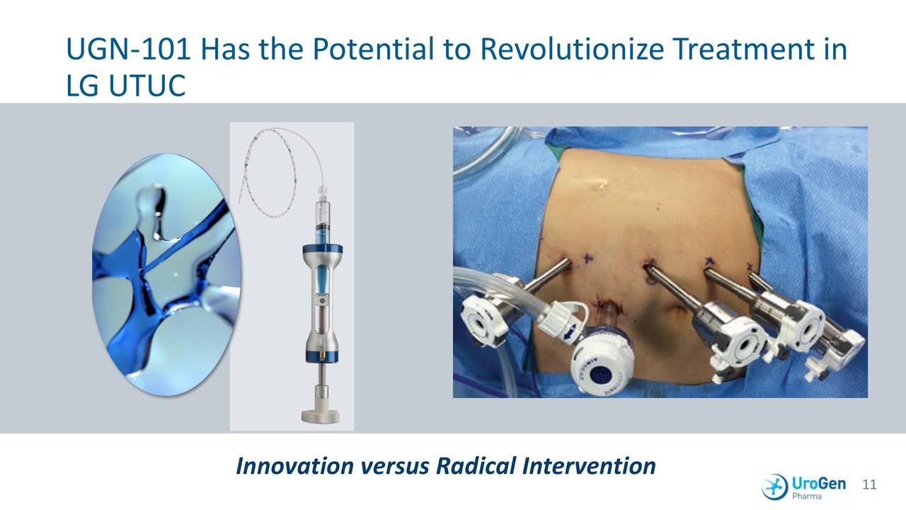 UroGen Pharma (URGN) Investor Presentation - Slideshow (NASDAQ:URGN ...