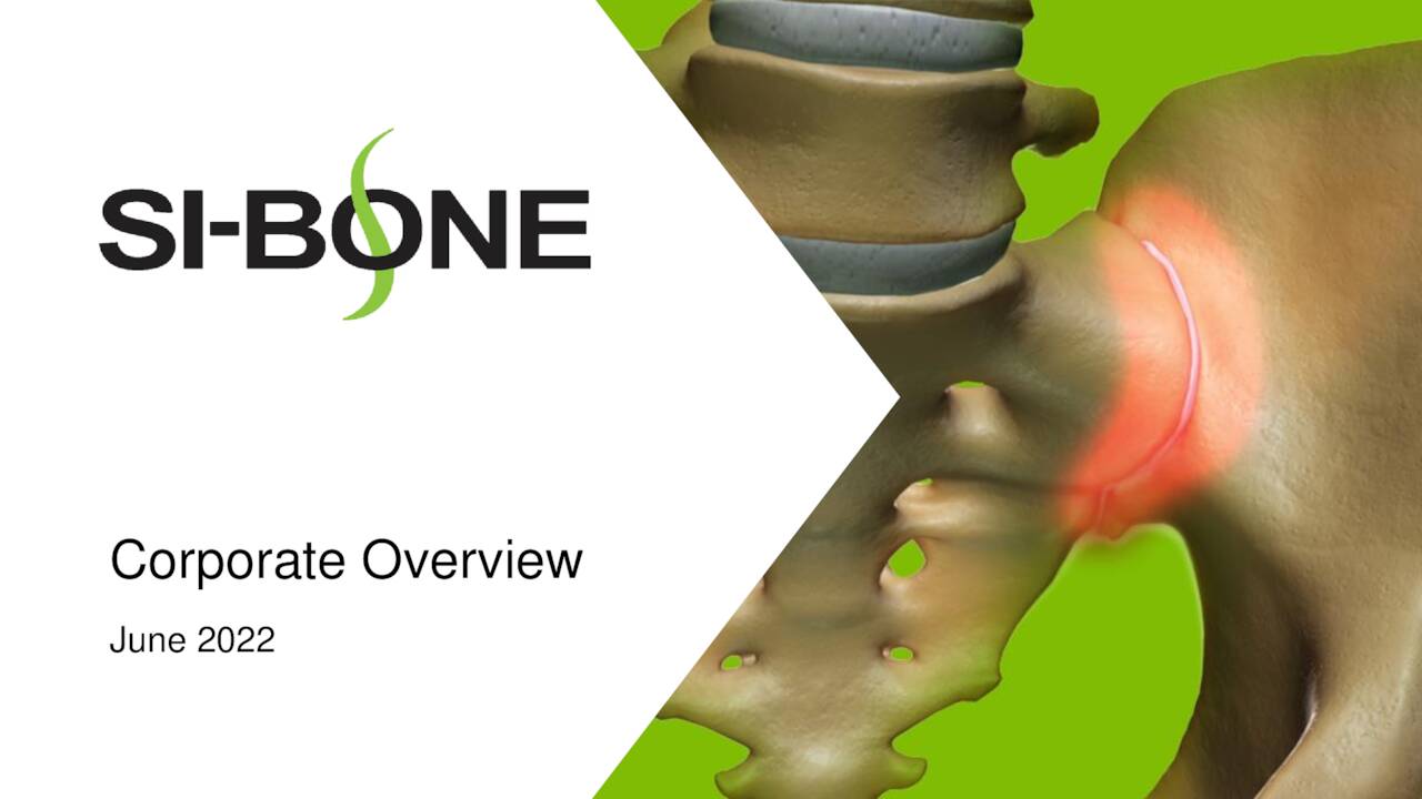SI-BONE (SIBN) Investor Presentation - Slideshow (NASDAQ:SIBN ...