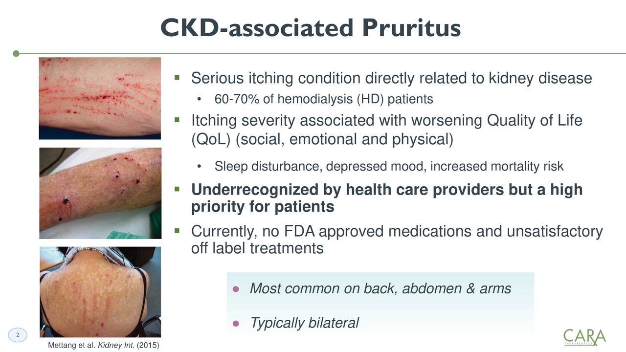 Cara Therapeutics (CARA) Presents At Boston Biotech NY/NJ CEO ...