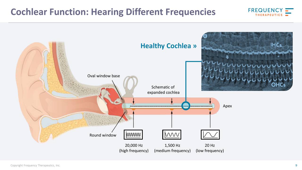 Frequency Therapeutics (FREQ) Investor Presentation - Slideshow (NASDAQ ...