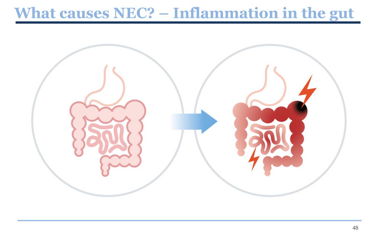 Infant Bacterial Therapeutics (IFTBF) Investor Presentation - Slideshow ...